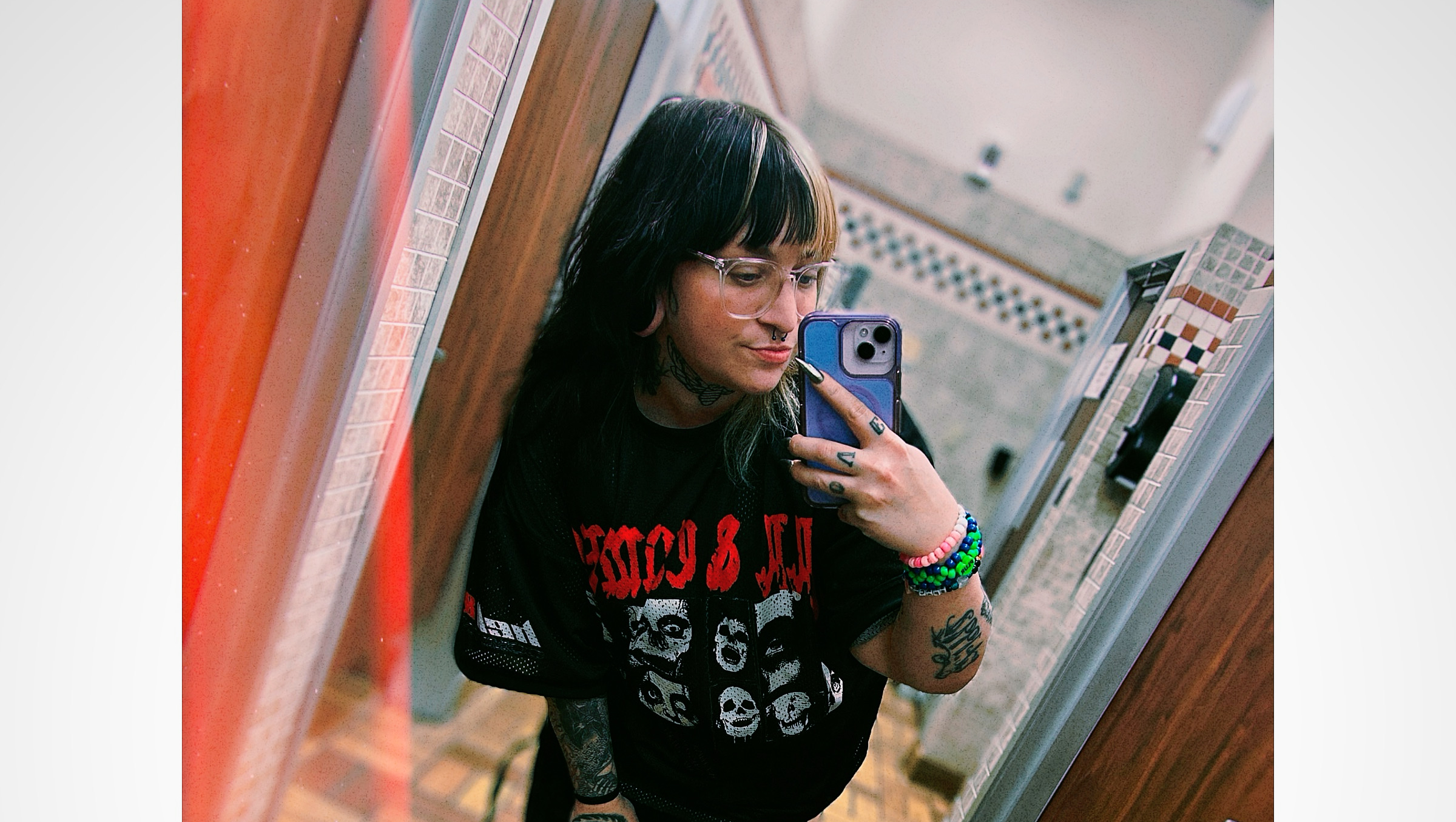 Fundraiser by Casey Sanwick : Help Mosh Smile Again with Urgent Dental Care
