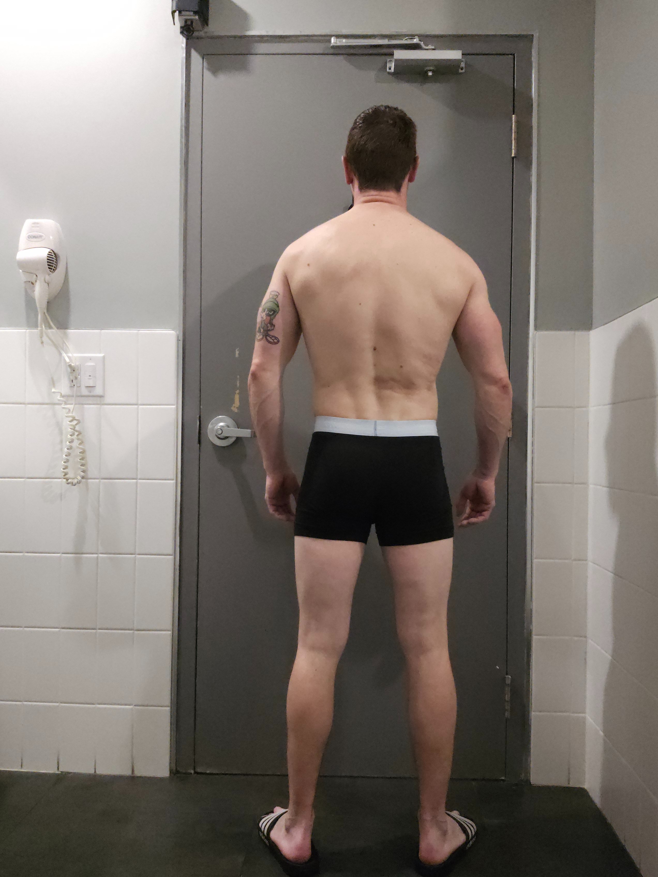 Fundraiser by Kyle Flanagan : Injured at work NO COMP (Back)Game ...