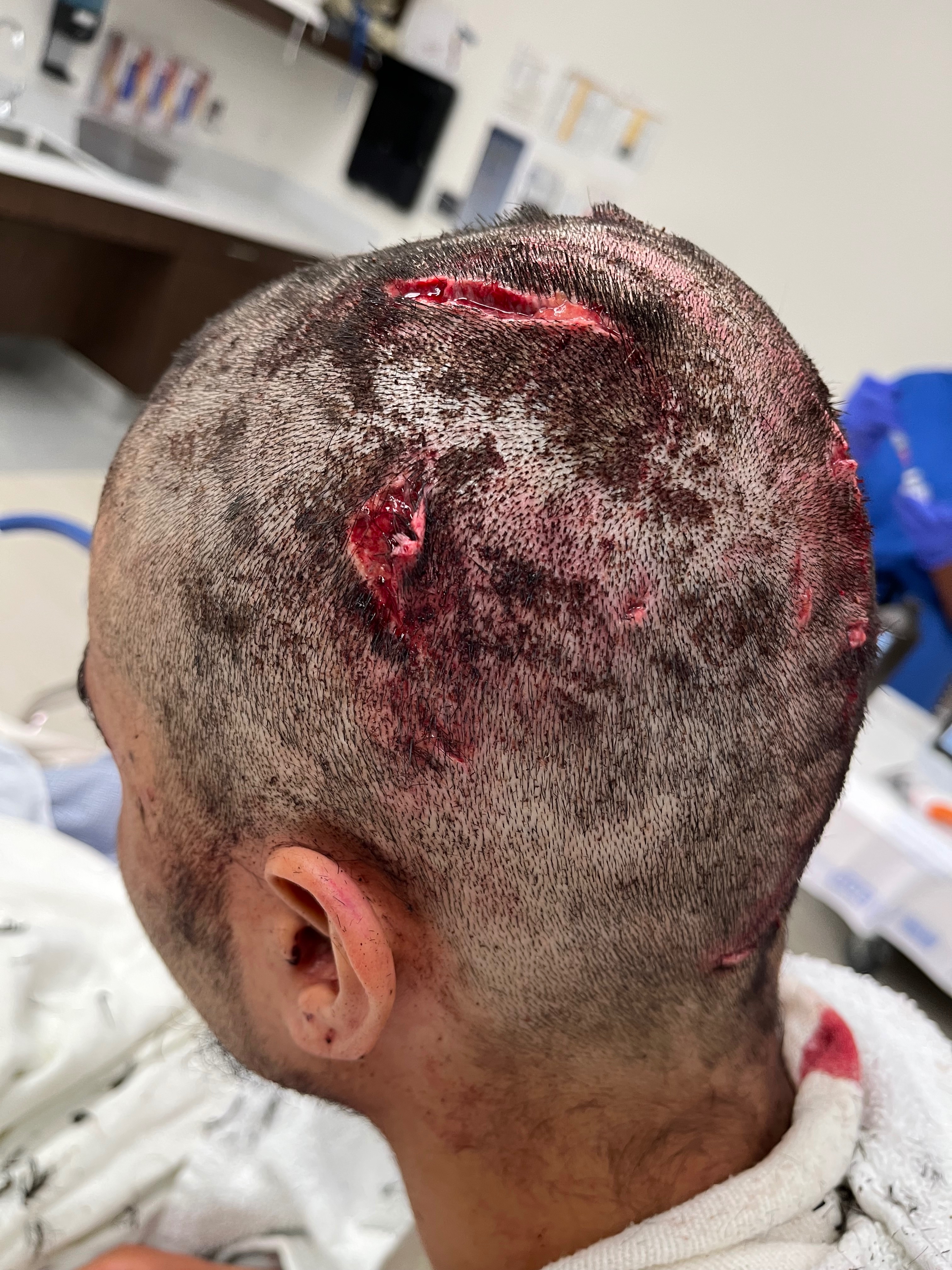 Fundraiser by Syed Ali : Help Syed Recover After Dog Attack