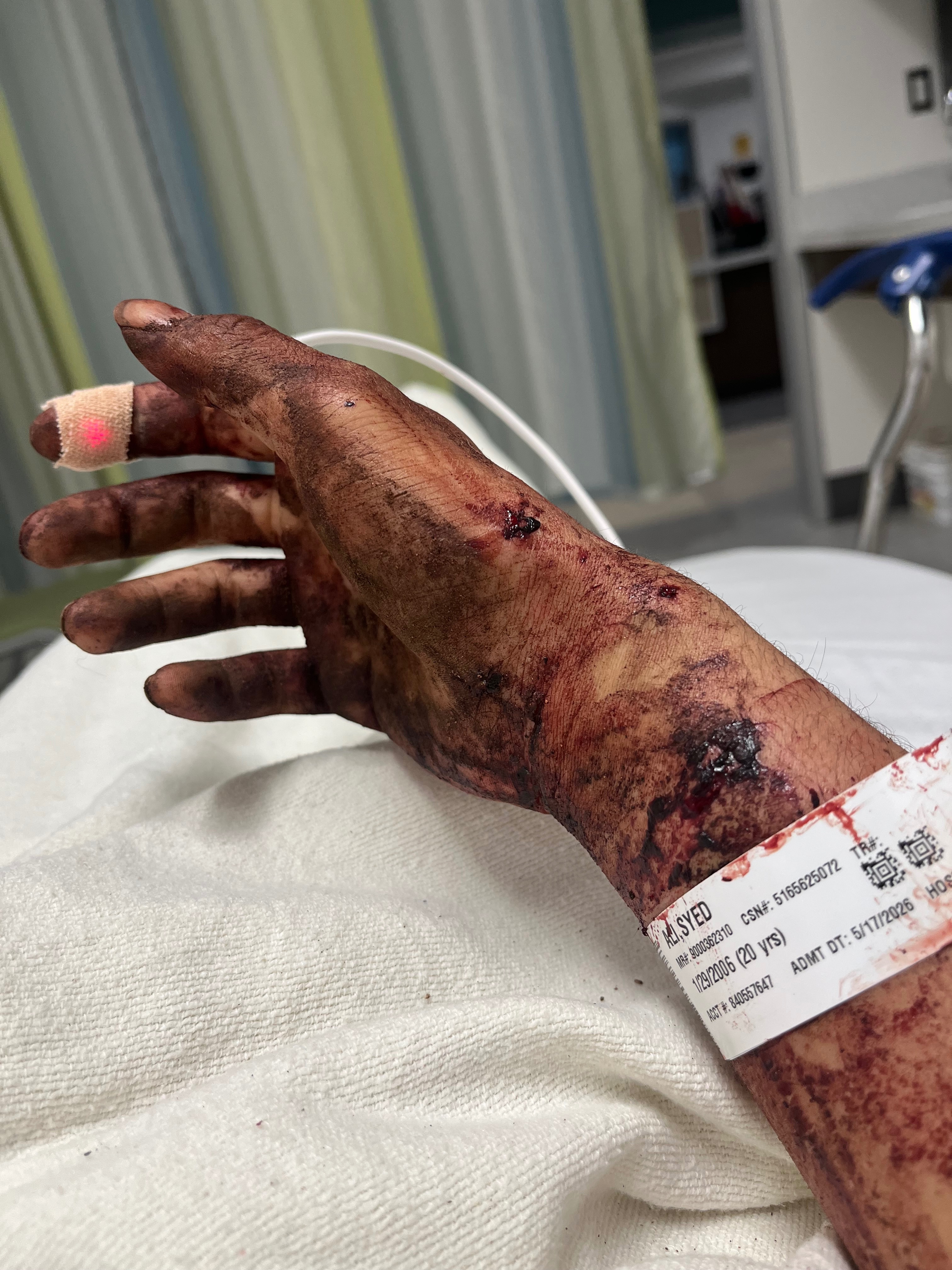 Fundraiser by Syed Ali : Help Syed Recover After Dog Attack