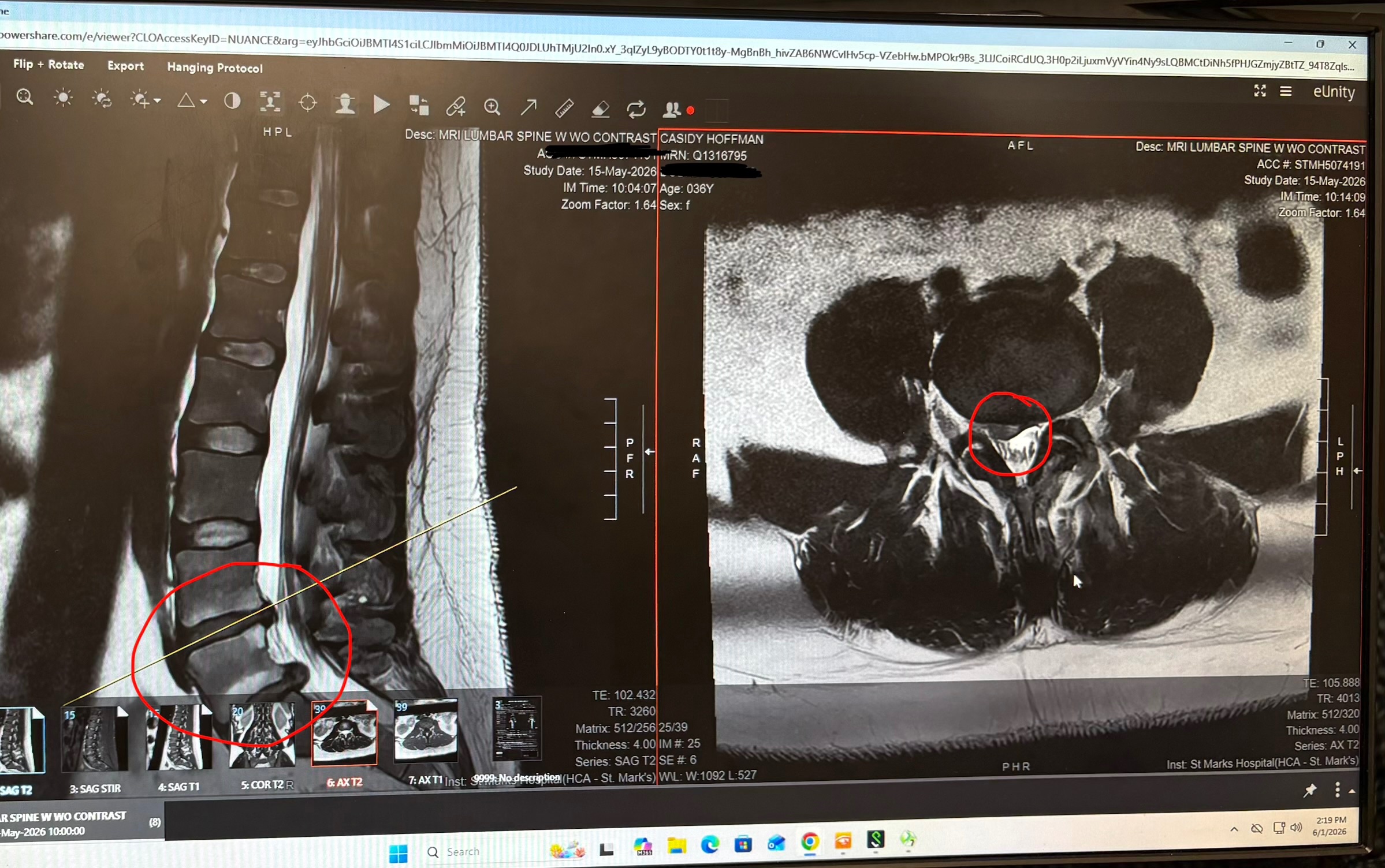 Fundraiser by Delaney Armijo : Help Casidy get Back Surgery