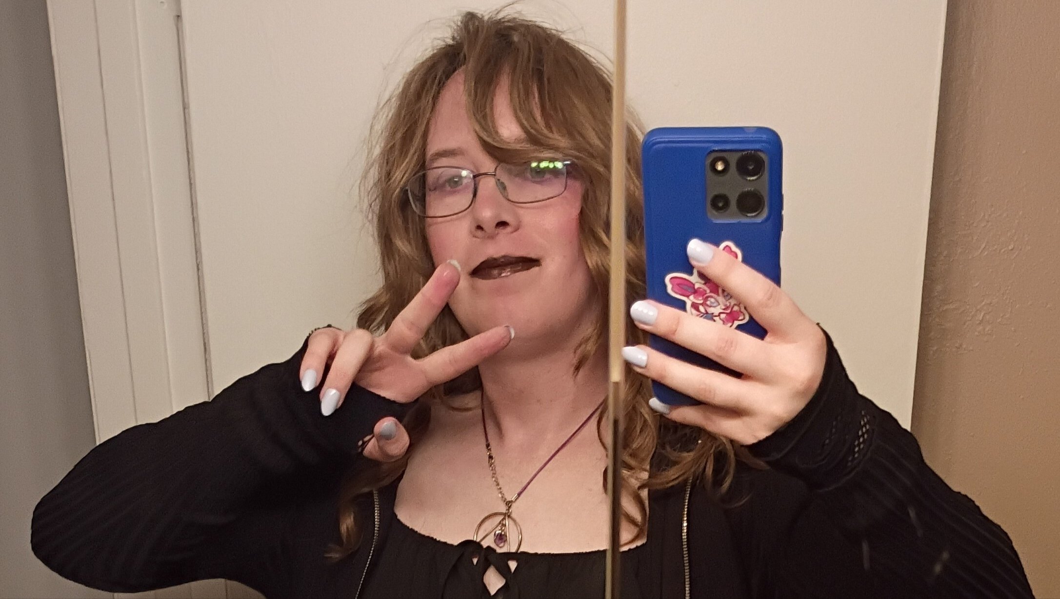 Fundraiser by Tali Apogee : Help Tali Cover Bills During Her Injury ...