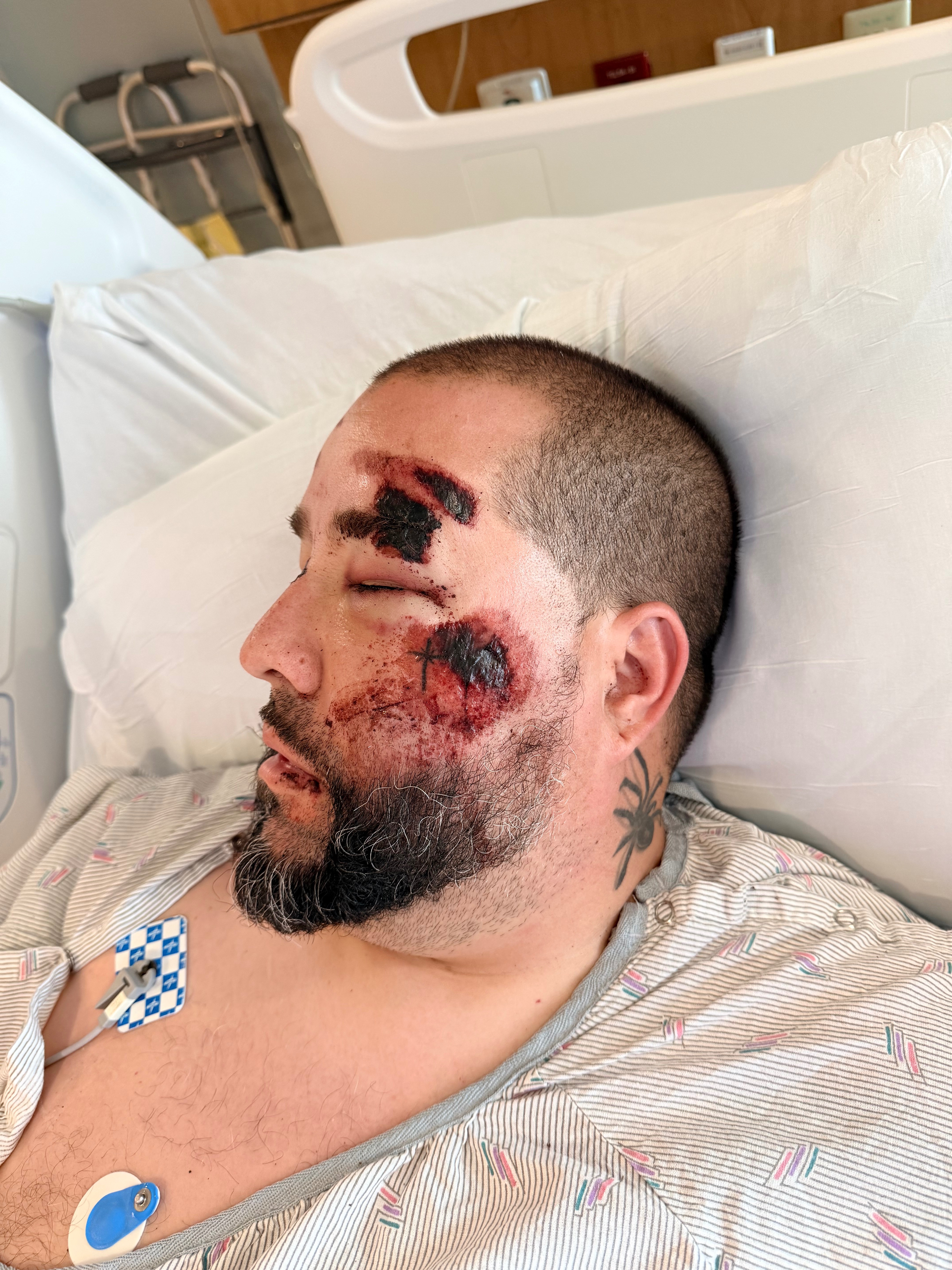 Fundraiser by Erica Nelson : Help Harold Recover from Severe Injuries