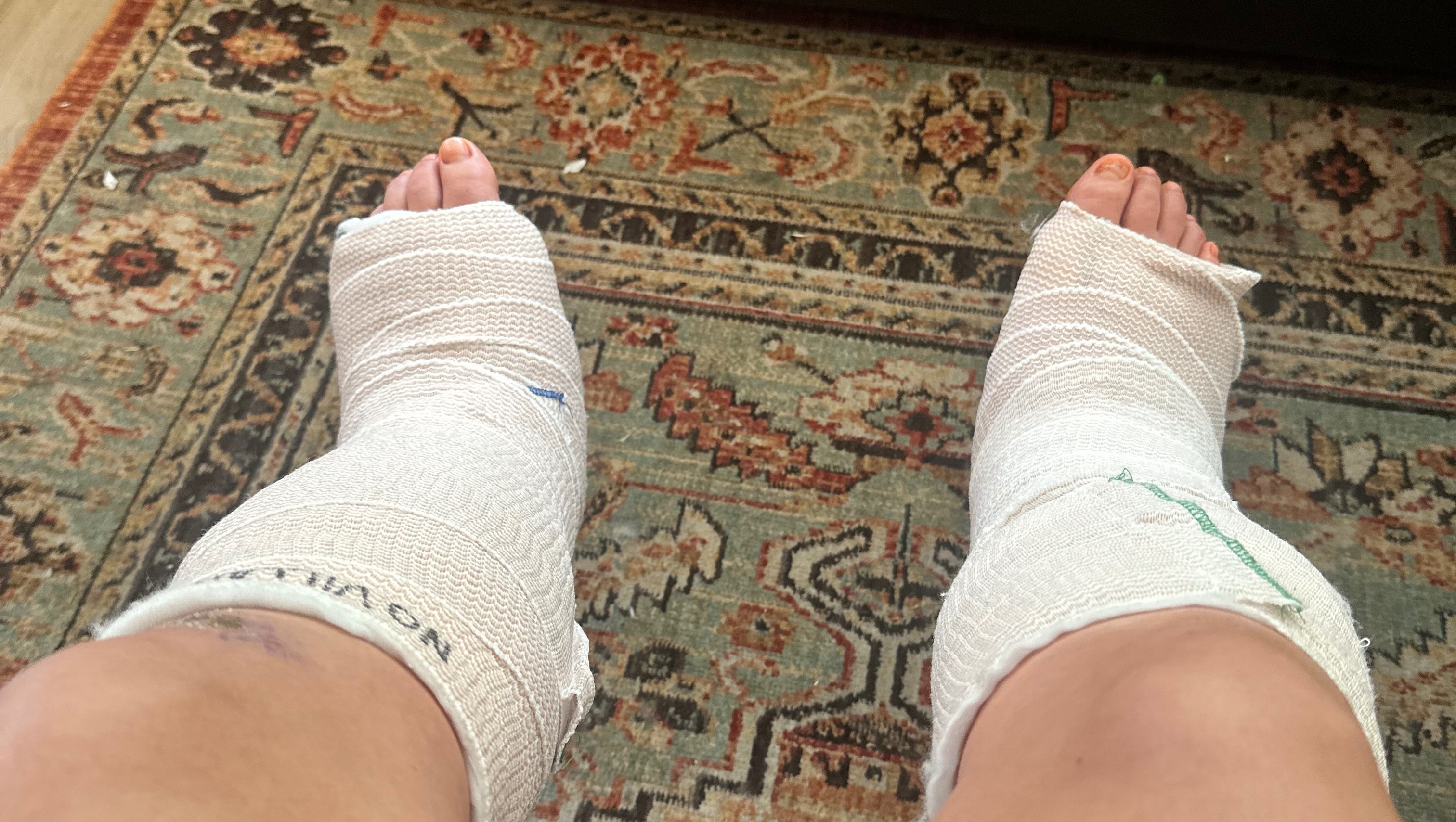 Fundraiser by Shea Schenderline : Broke both my ankles PLEASE HELP!!