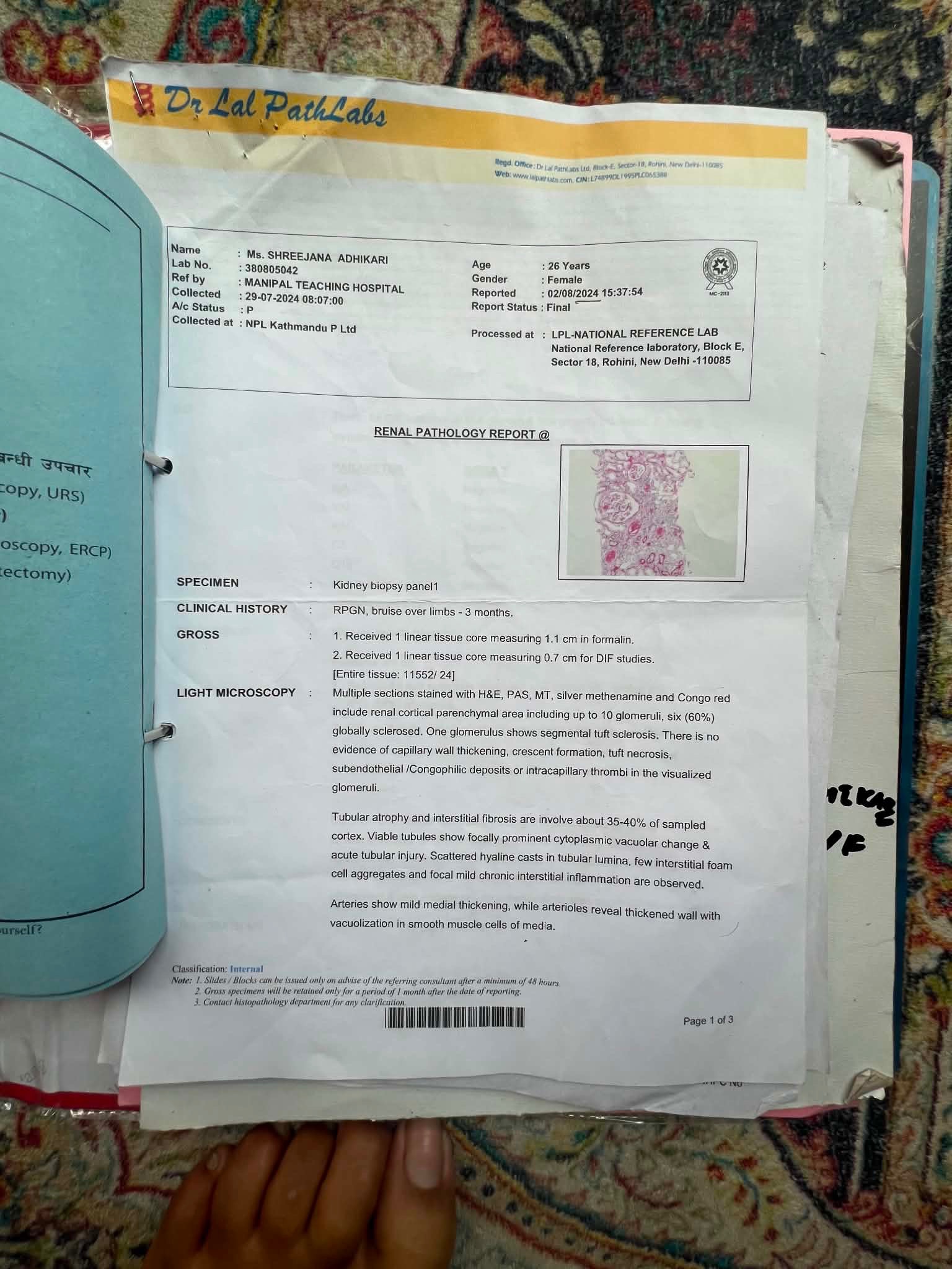 Fundraiser by Somiya Dahal : Donate to help Srijana to get her life back