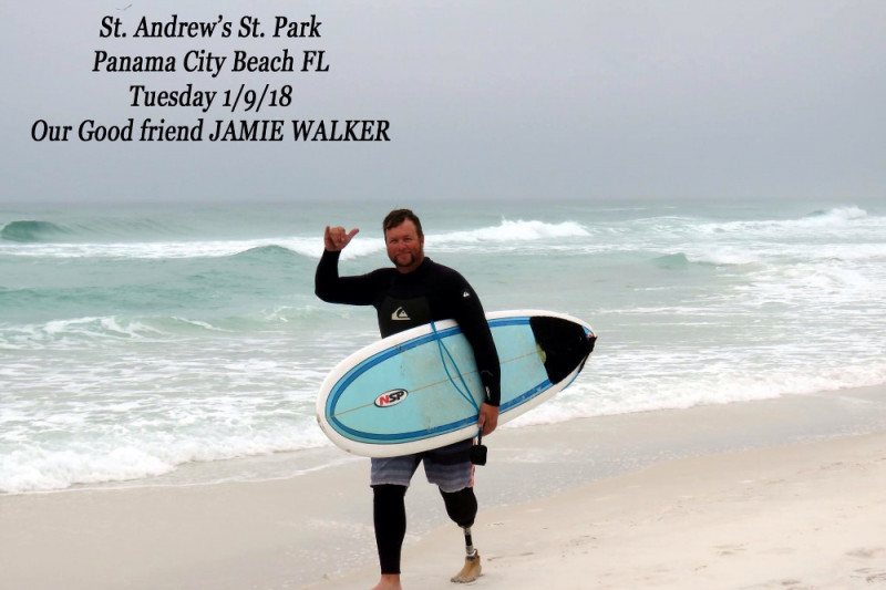 Fundraiser for Kelly Walker by Lori Ann Rice : Jamie's Amputation ...