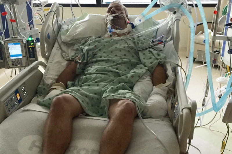 Fundraiser for Tony Tinsley by Mark Chastain : Tony Tinsley