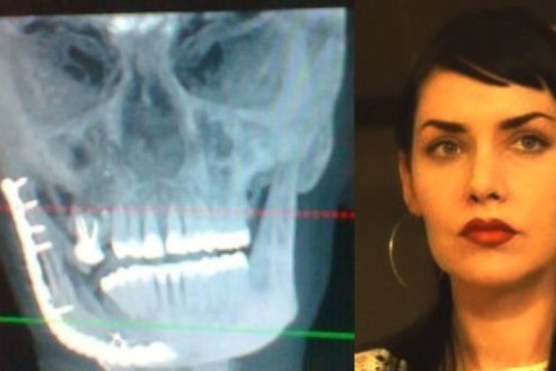 Fundraiser for Wendy O'Rourke by Ryn Foxe : Wendy O'Rourke's Jaw Surgery!!