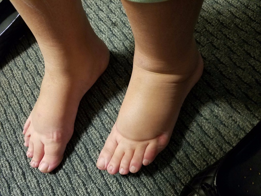 Fundraiser for Lisa Clark by Jason Magoon : Maleah's Cancer Treatment Fund