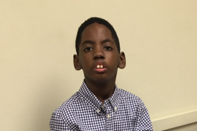 Fundraiser by Kesha Fowler-Griffin : Kaleb's new Smile