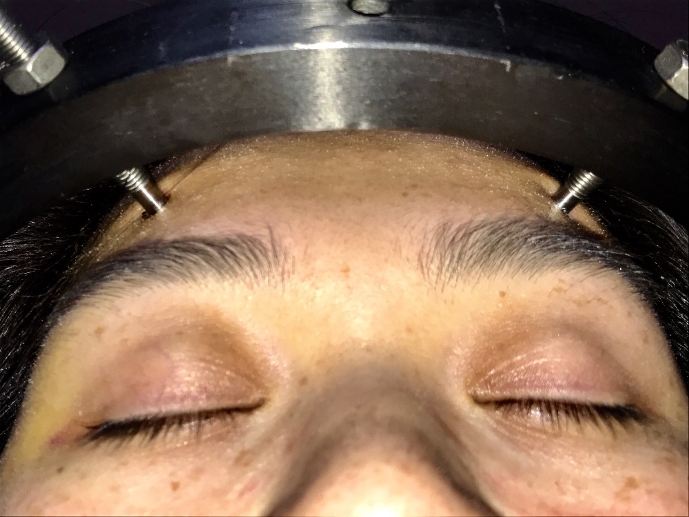 Fundraiser by Victoria Ye : Hit and Run by an uninsured driver