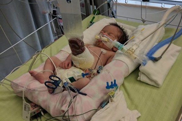 Fundraiser for Anna Maria by Shelby Lee : Gastroschisis Baby Cambria