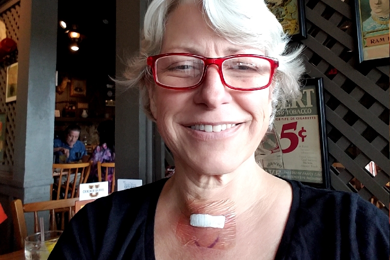 Fundraiser for Allison Gillespie by Casey Gillespie : Allison's Surgery ...