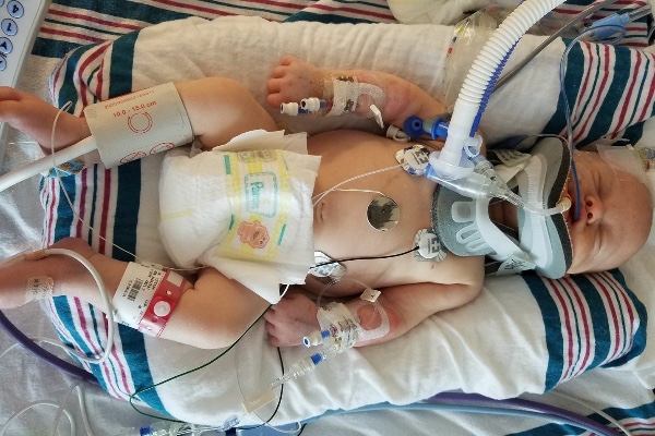 Fundraiser for Zackery Flurry by Amy Marie Foster : Please help Baby ...