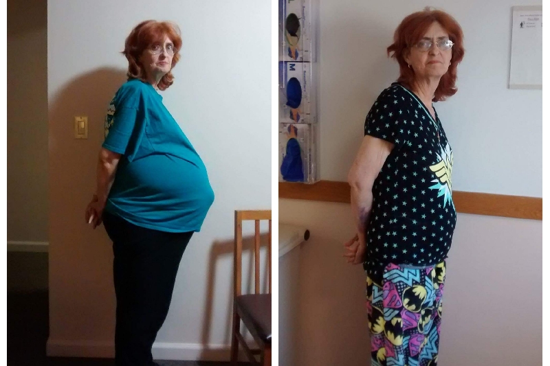 Fundraiser by Robynne Russum Ryals : Saving My Sister