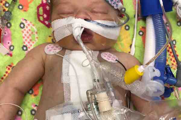 Fundraiser by Jon Rohman : Hadlee Rohman HLHS Medical Relief