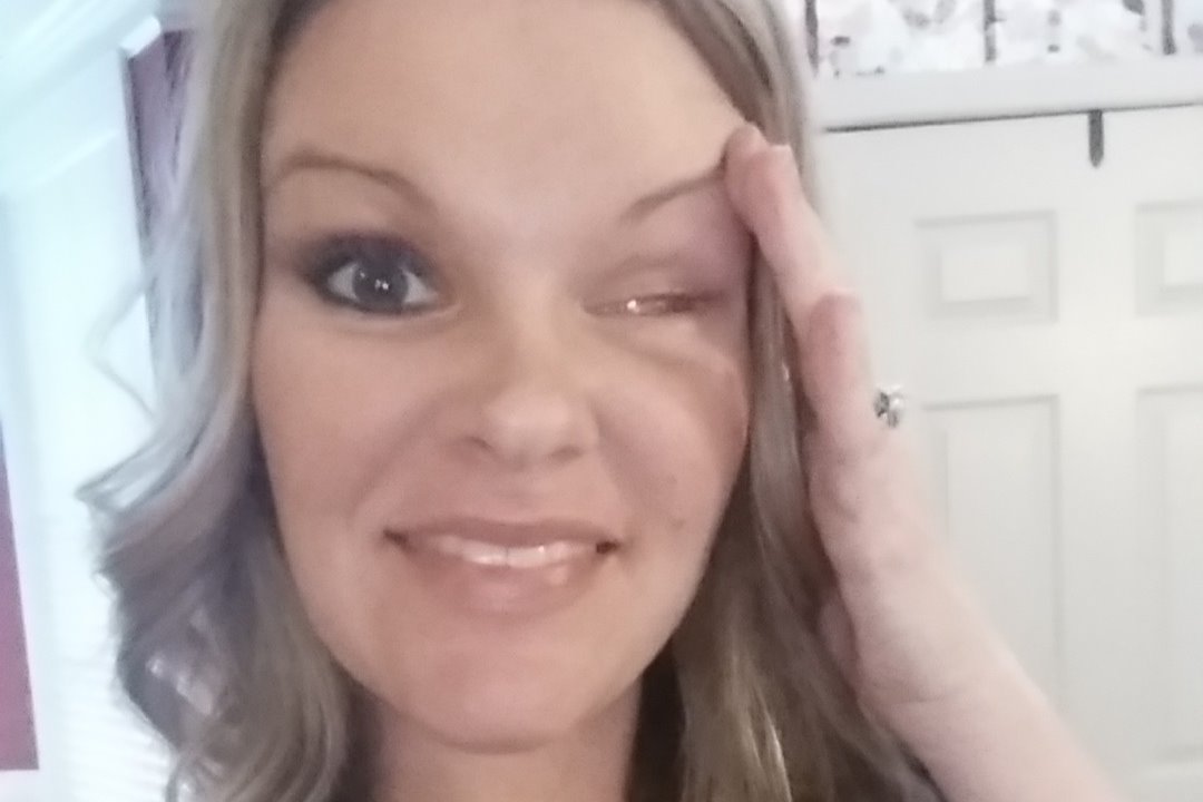 Fundraiser for Tara Panek by Melissa Apel : Ocular Melanoma