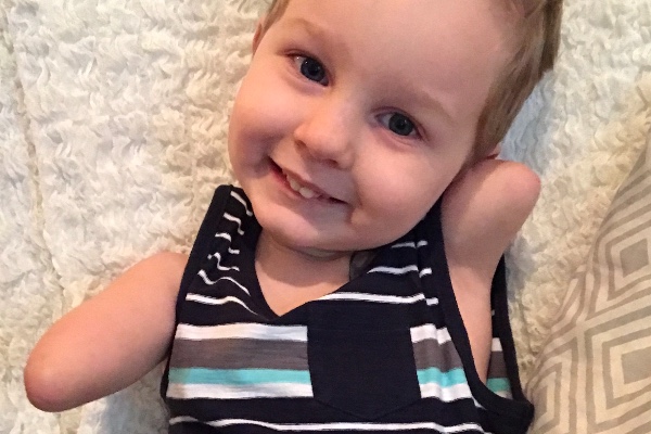 Fundraiser by Katie Danielle Whiddon : A limb different dog for Camden