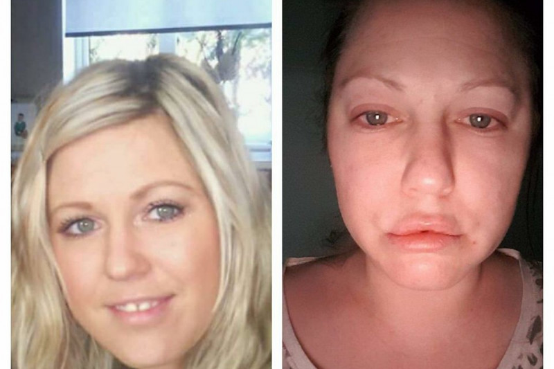 Fundraiser for Jade Thomson by Nicola Lavin : Stem Cells for Jade Thomson