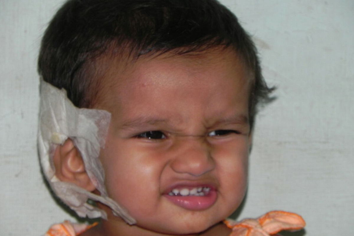 Fundraiser by Thomas Jacob : Gaggan Anoop - Surgery