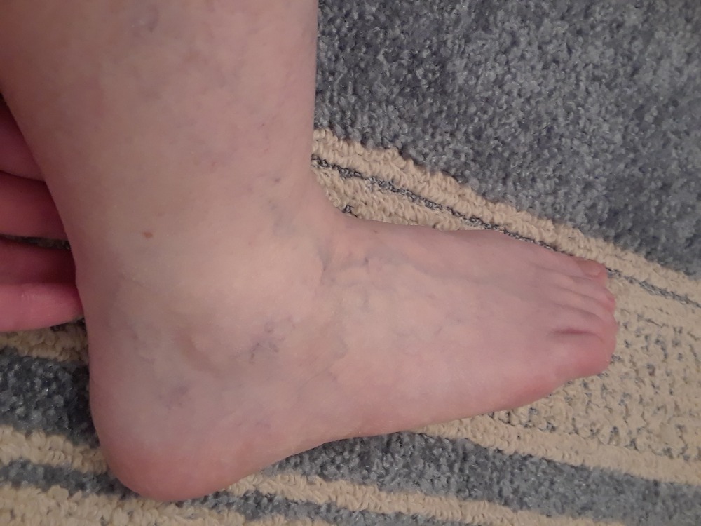 Fundraiser by Kelly Wooldridge : Kelly's Medical