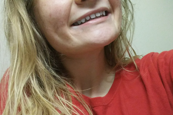 Fundraiser for Krista Stewart by Sarah Stewart : For Braces