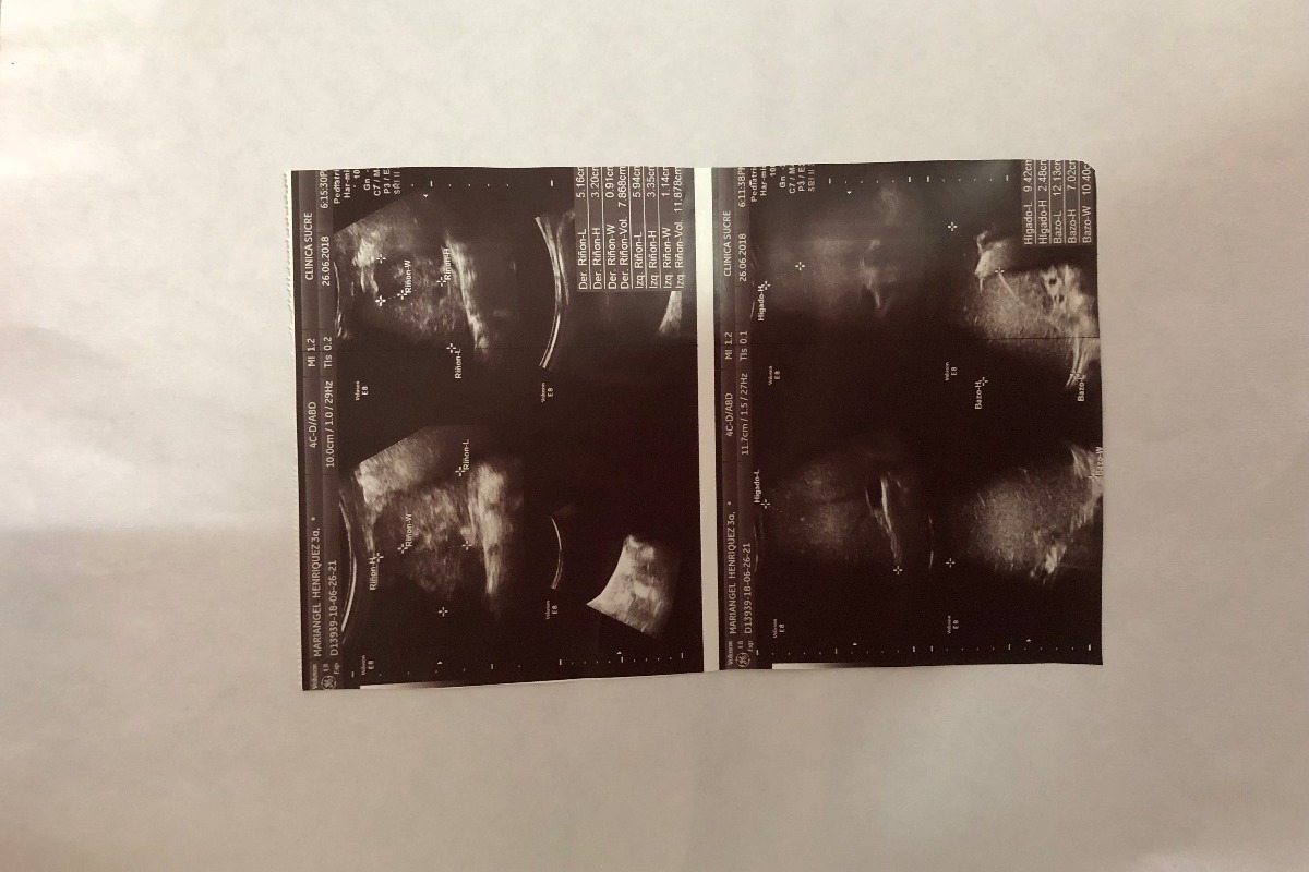 Fundraiser for Genesis Cubillan by Adan Henriquez : Mariangel Henriquez