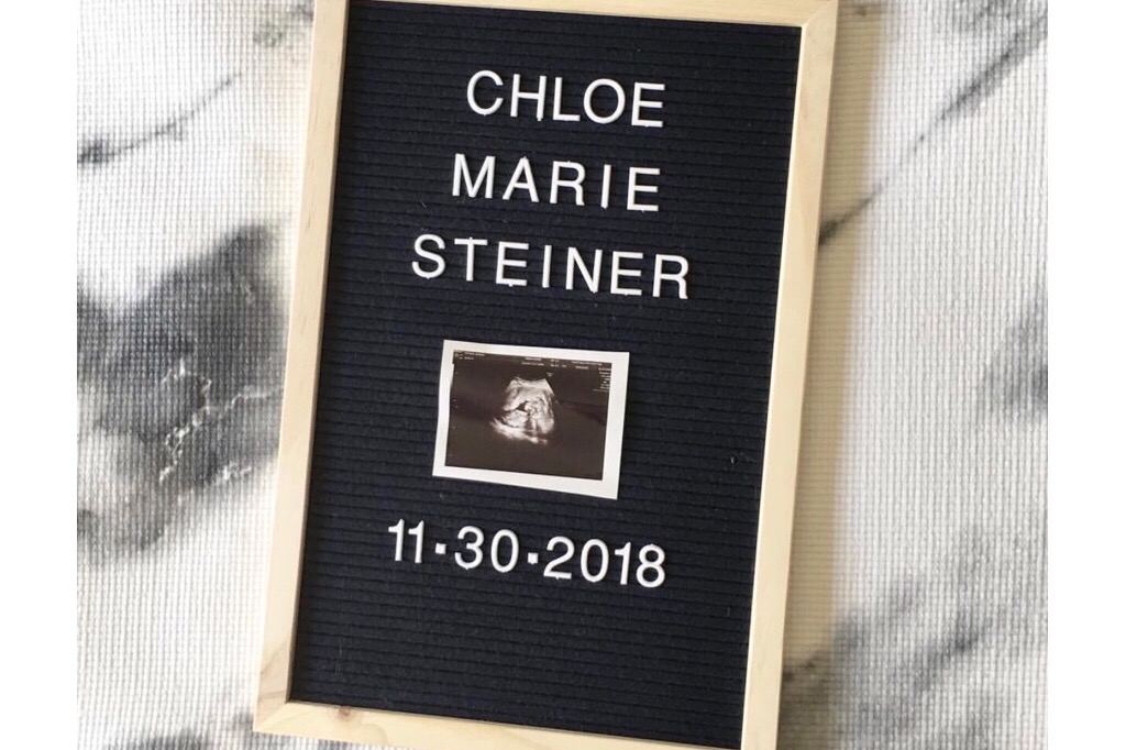 Fundraiser for Rowan Steiner by Alex Dierks : Chloe Steiners Funeral Costs