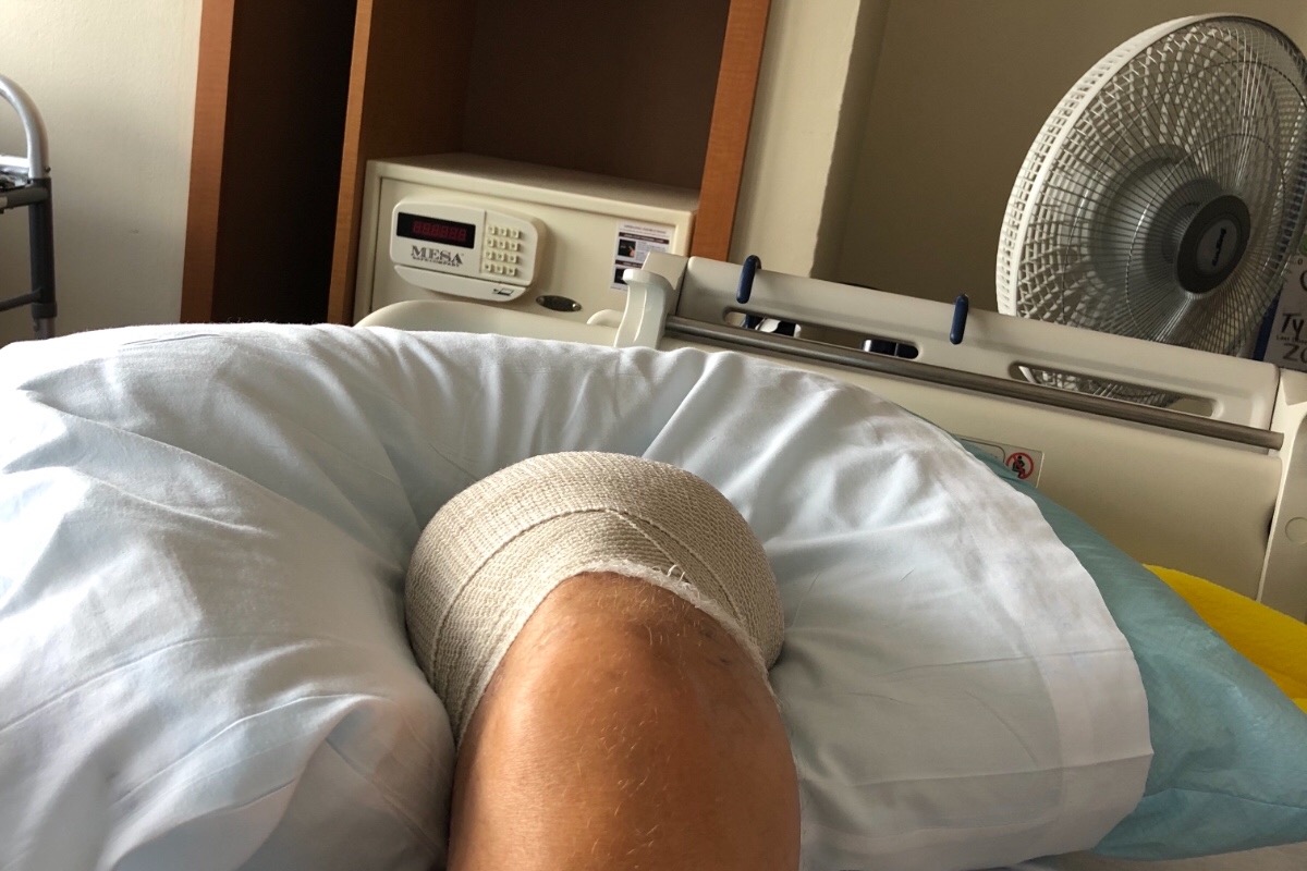 Fundraiser by Alfred Carlsen : Al needs a leg to stand on