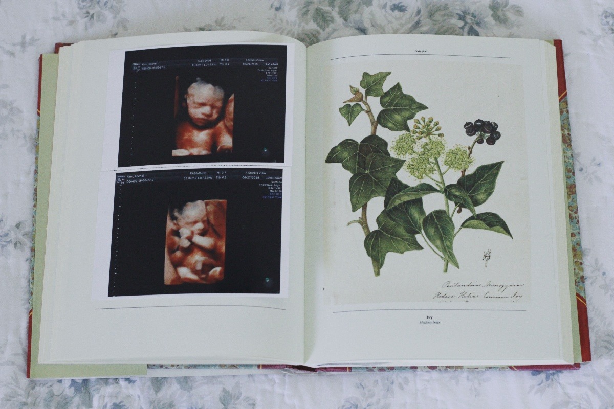 Fundraiser by Geoffrey Finn : Ivy's Story: HLHS with IAS