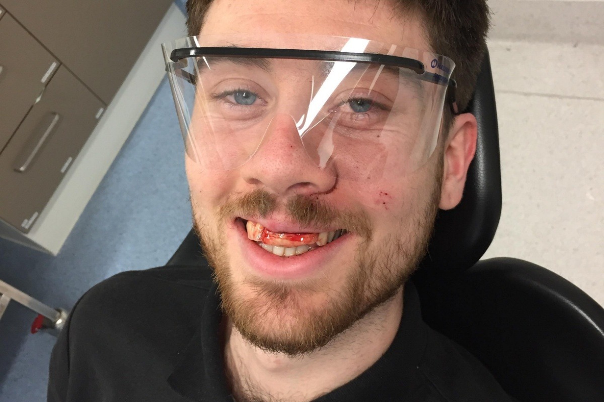 Fundraiser by Xan Jack Fairweather : Joshua Law teeth surgery