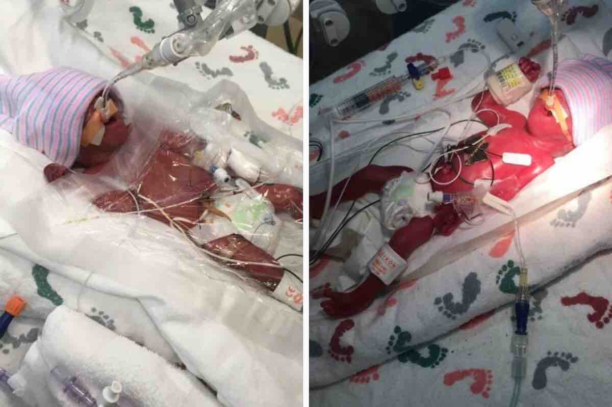 Fundraiser for Timothy Dorcey by Lisa Tooley : Dorcey Twins