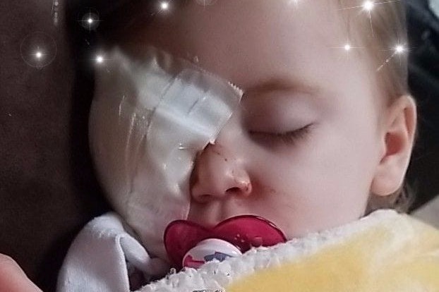 Fundraiser for Robin Stine by Lisa Landis : A prosthetic eye for 2 year ...