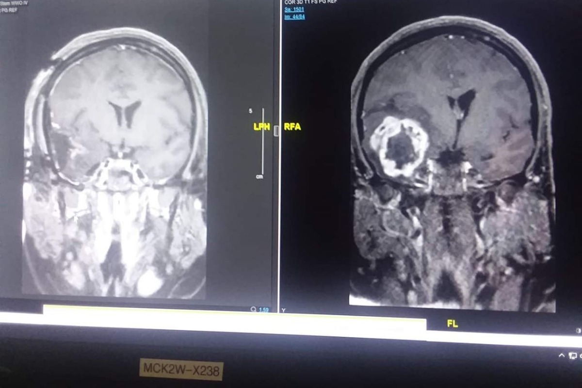 Fundraiser for Mindy Poncelet by Christina Halverson : Helping with ...