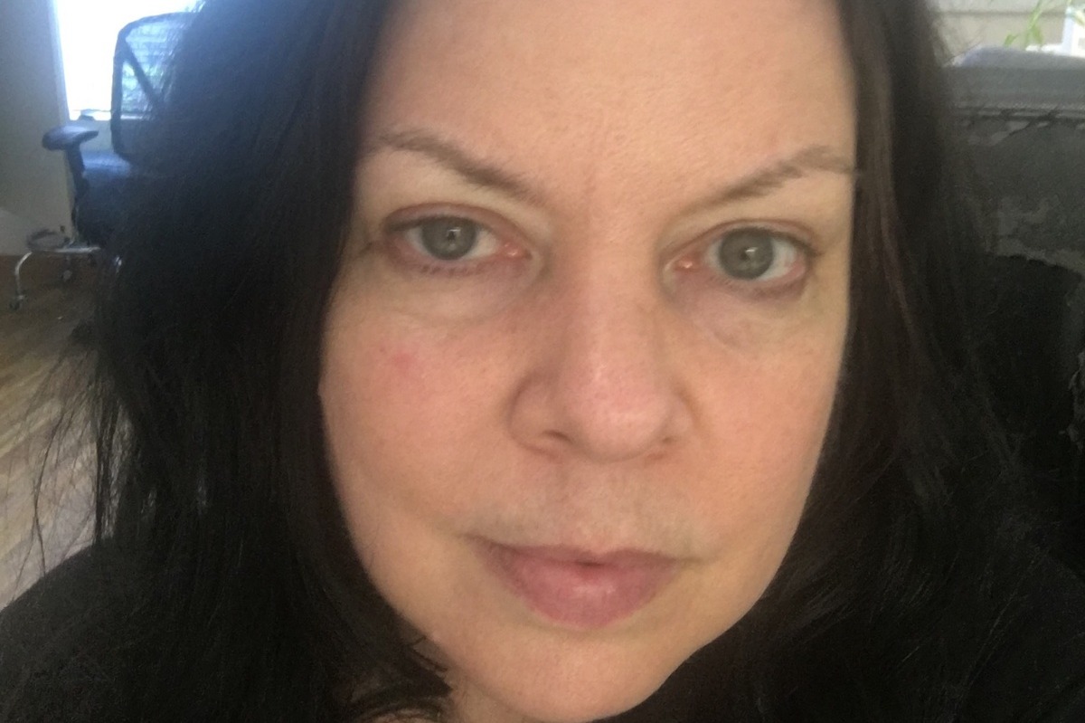 Fundraiser for Susan Gruber by Elsa Davenport : Help Susan with medical ...