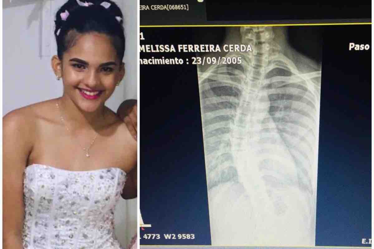 Fundraiser by Melanie Espinal : Ayuda a Melissa Ferreira Cerda