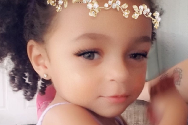 Fundraiser by Elizabeth Lingerfelt : Ella's Special Eye..