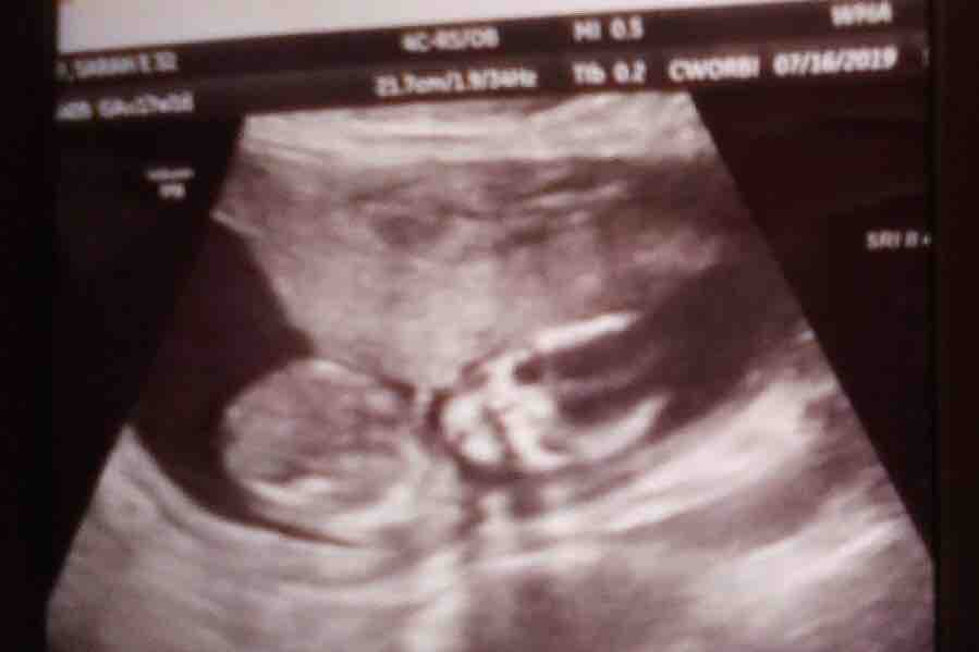 Fundraiser for Matthew Delp by Dorothy Ashley : Team Waylon James