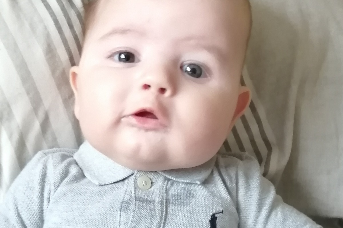 Fundraiser by Jenna Fenton : Plagiocephaly, cranio helmet for Victor Henney