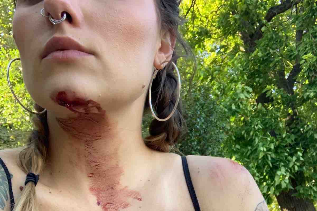 Fundraiser for Taylor Mabbott by Madison Cates : Taylor Took a Gnarly ...