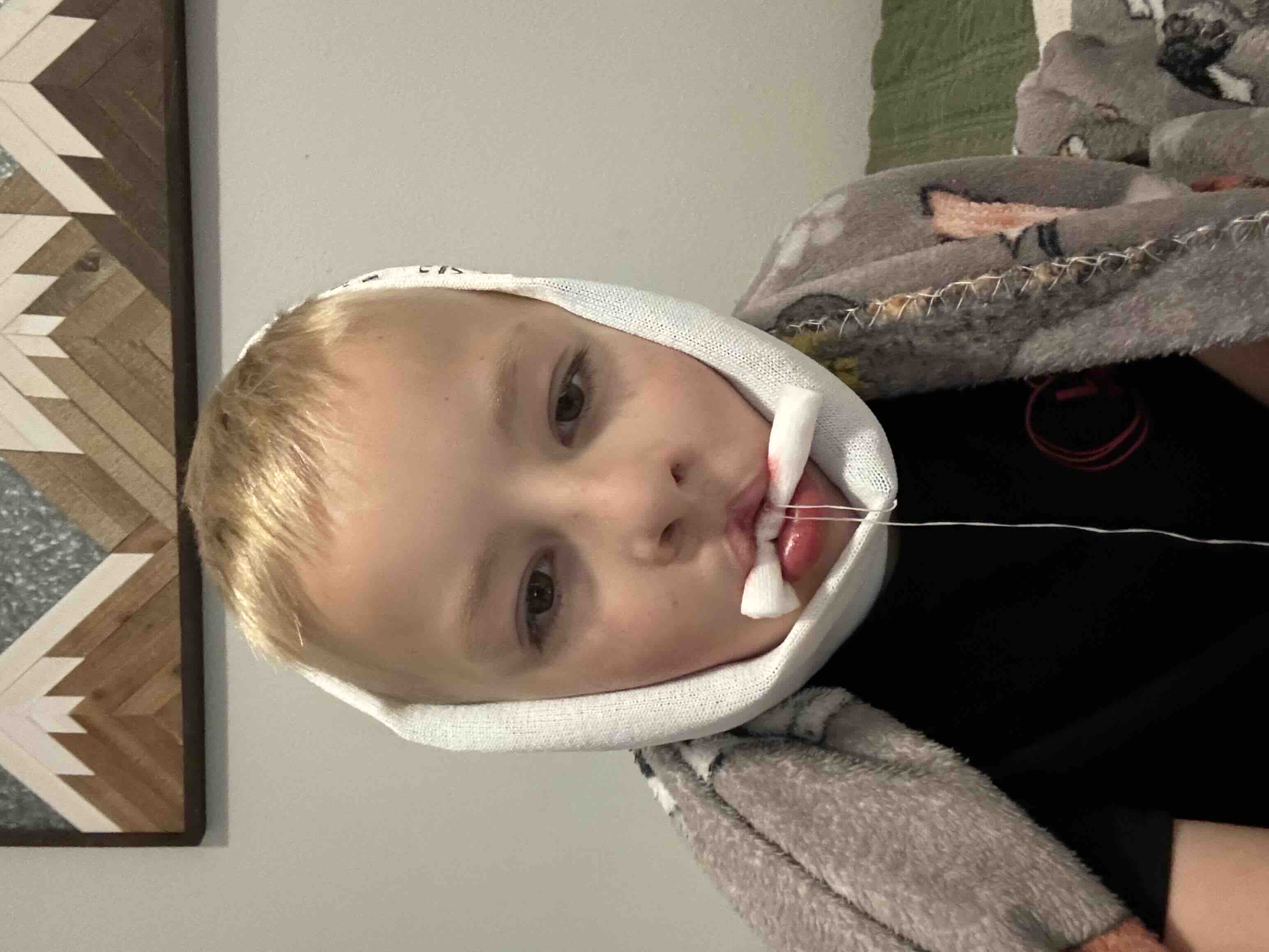Fundraiser By Jessica Bentley Cleft Palate Surgery Costs