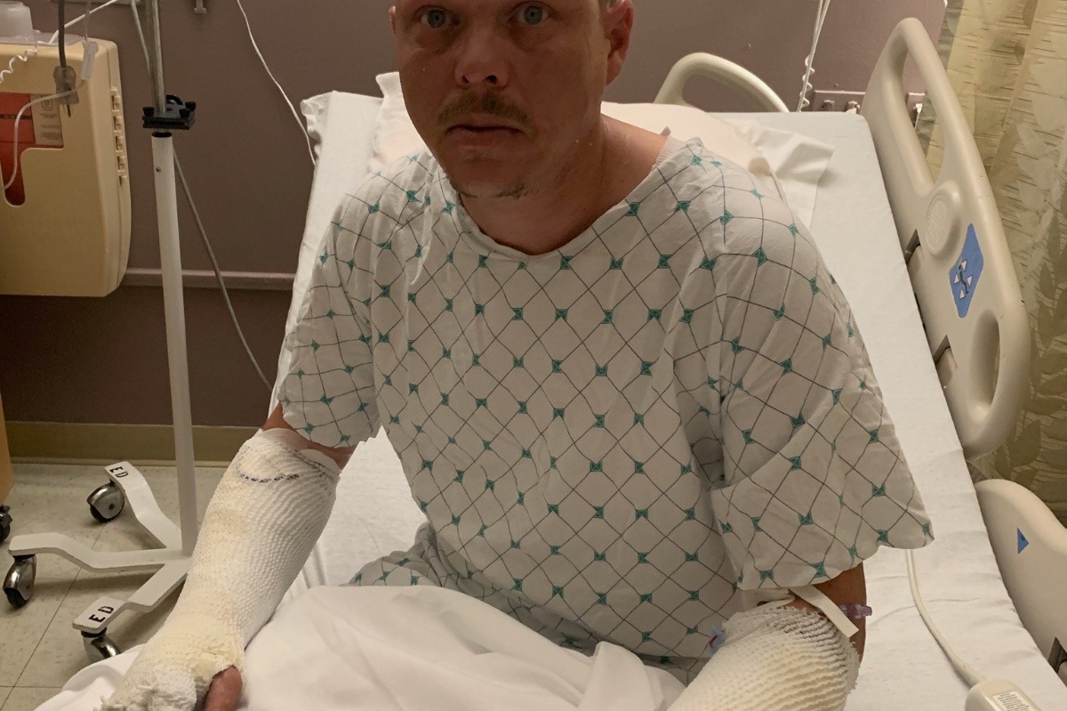 Fundraiser for Haleigh Ruppenthal by Joe Ruppenthal : Burned fire fighter