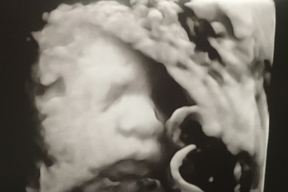 Fundraiser for Christina Yim by Juana Abbondanza : A New Moon! Help ...