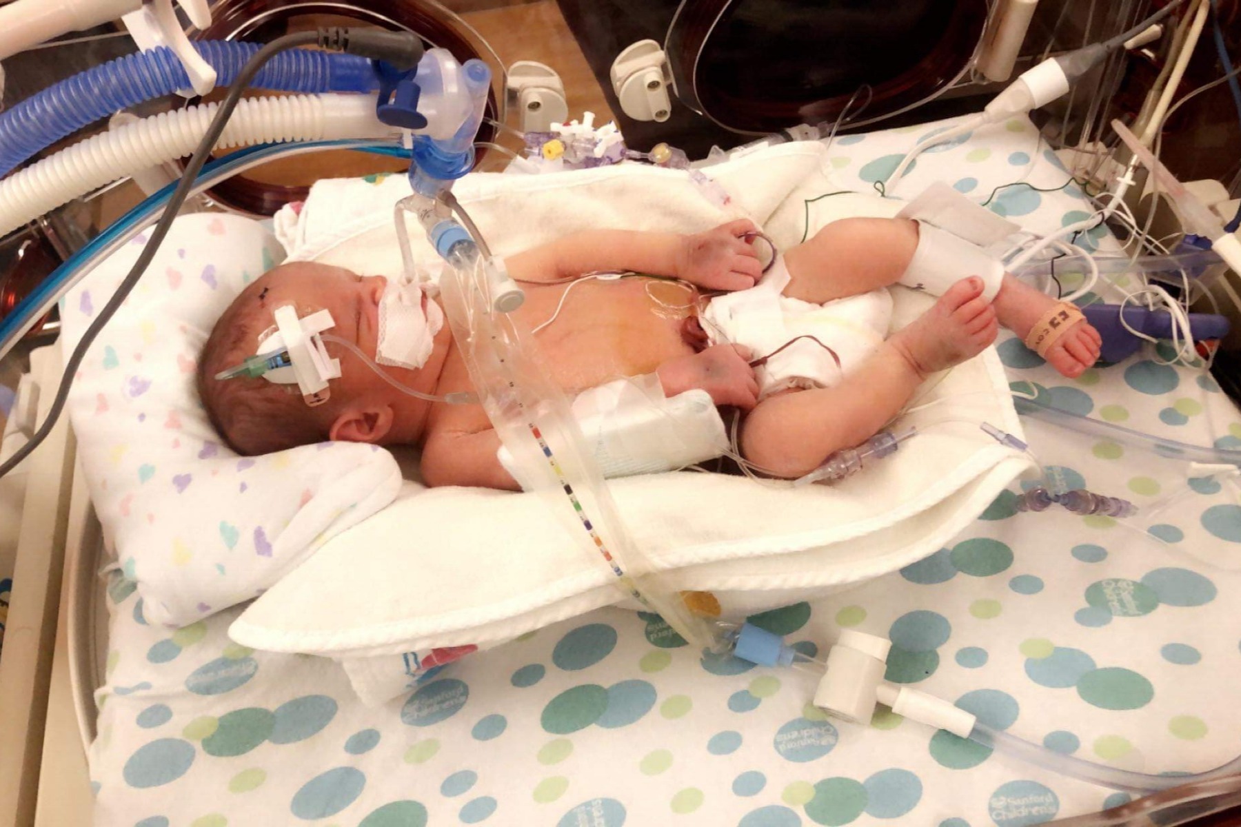 Fundraiser for Jonathan Morales migenes by Jaime Brockhoft : Baby ...