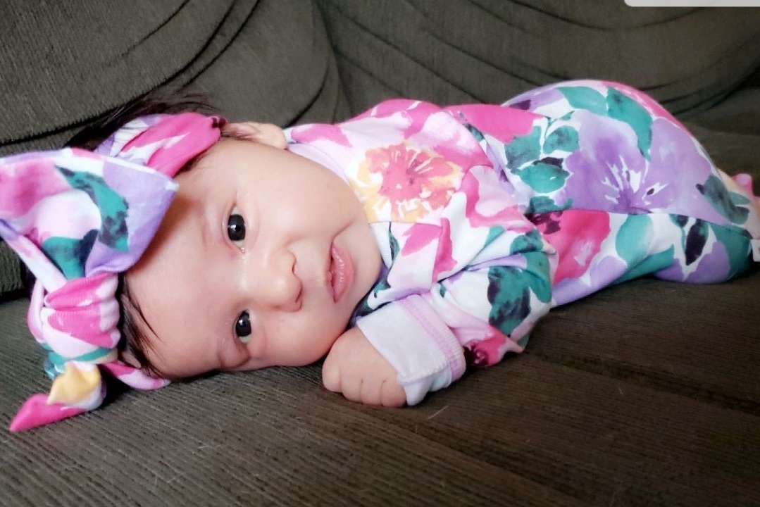 Fundraiser by Josh Gardner : Surgery For Amara Rose