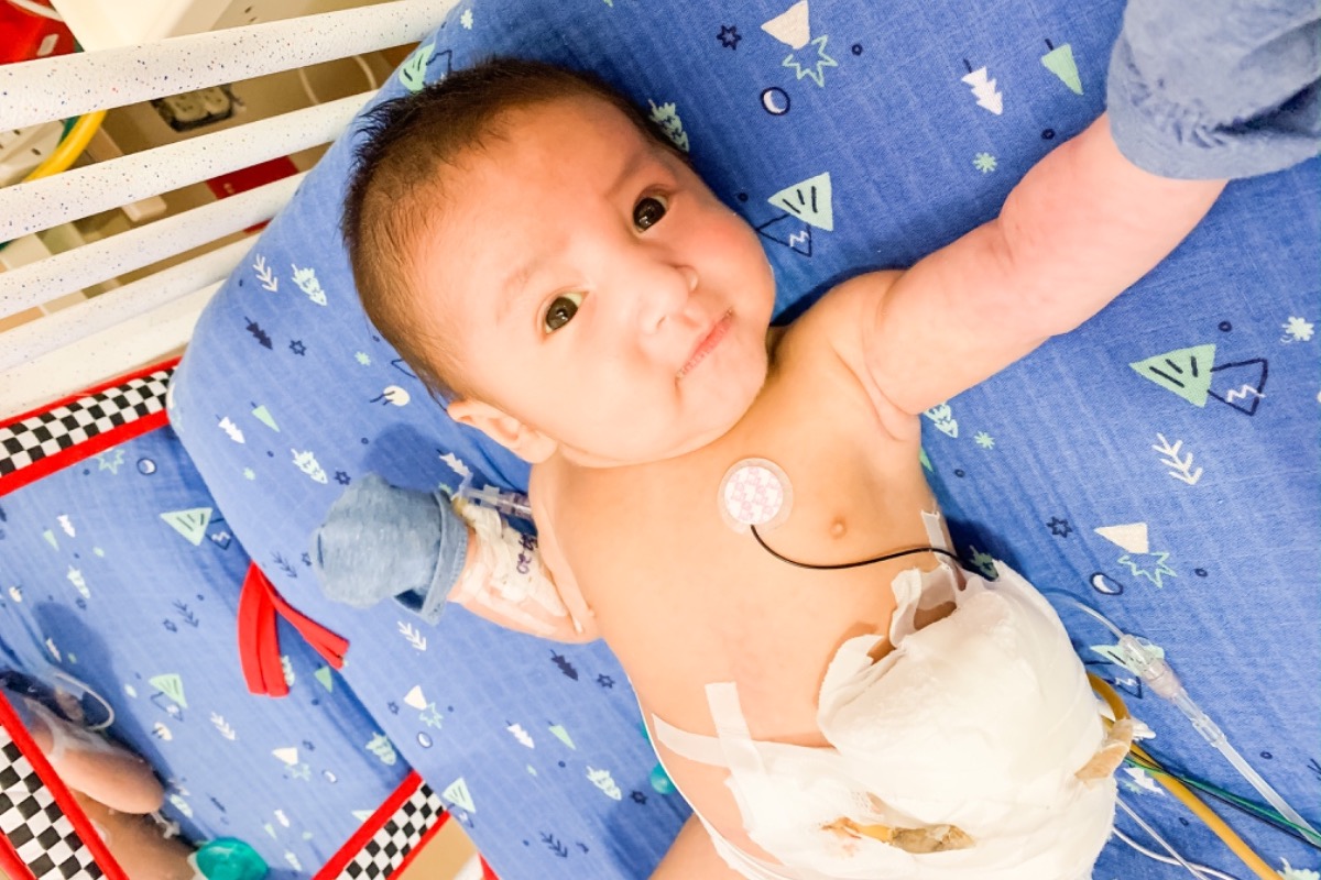 Fundraiser by Emily Medrano : Aaron’s Battle with Small Bowel Atresia