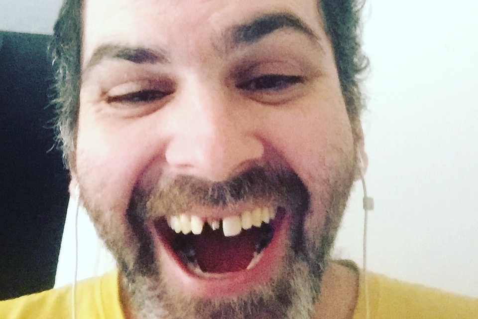 Fundraiser by Scott Bowser : Scott Bowser Dental Bone Graft