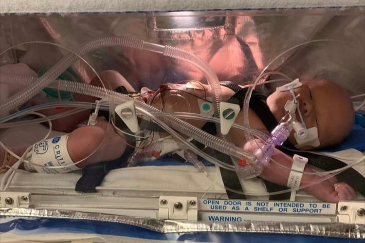 Fundraiser by Heather Wilder : Baby Weston Clay Wilder - a miracle boy ...