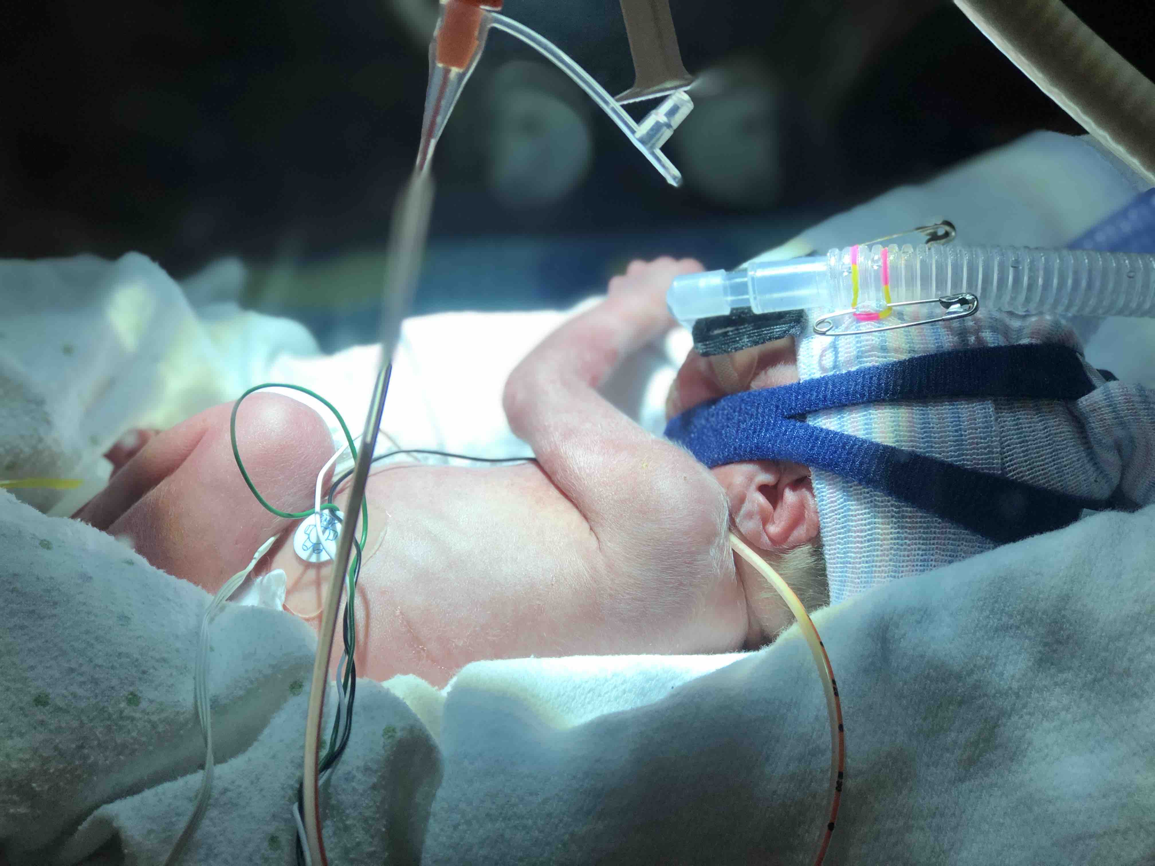 Fundraiser by Jade Derossett : Baby Scarlett