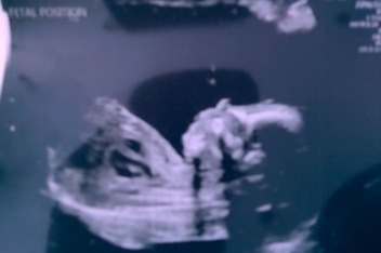 Fundraiser for Benjamin Polanco by Jennifer Polanco : Emergency Funds ...